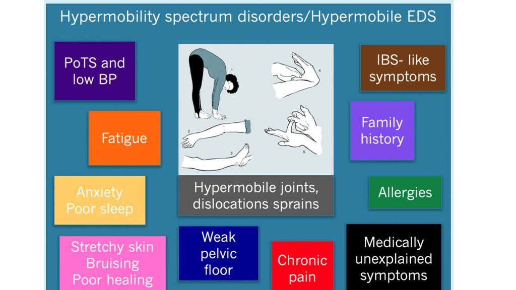 Hypermobility from a Mind Body perspective - SIRPA UK